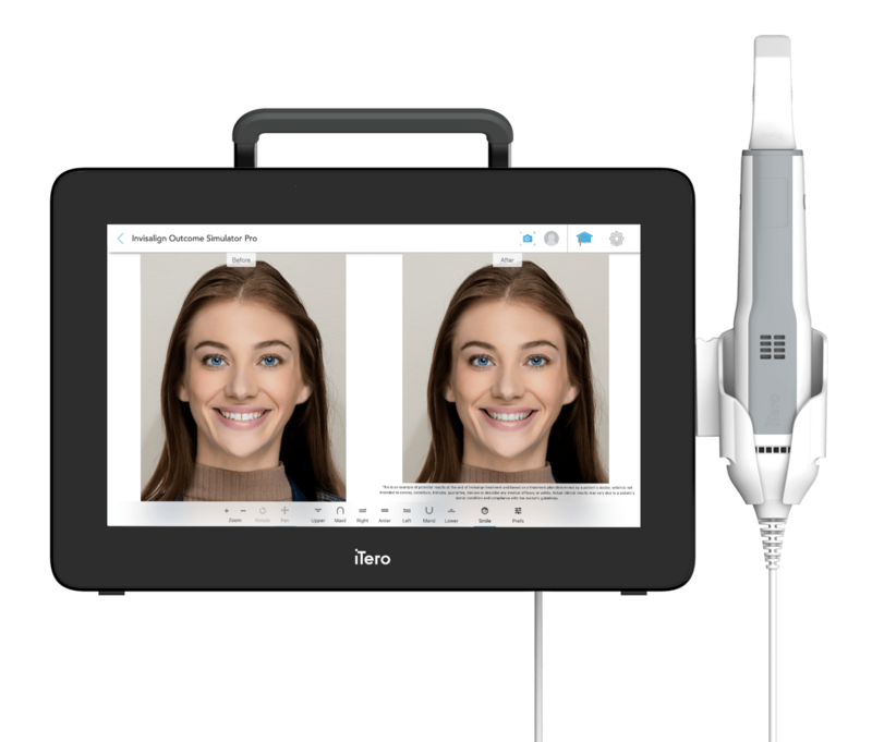 iTero Element 5D Plus - Le scanner intra-oral le plus puissant