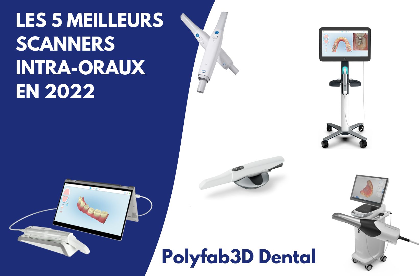 Le comparatif des 5 meilleurs scanners intra-oraux