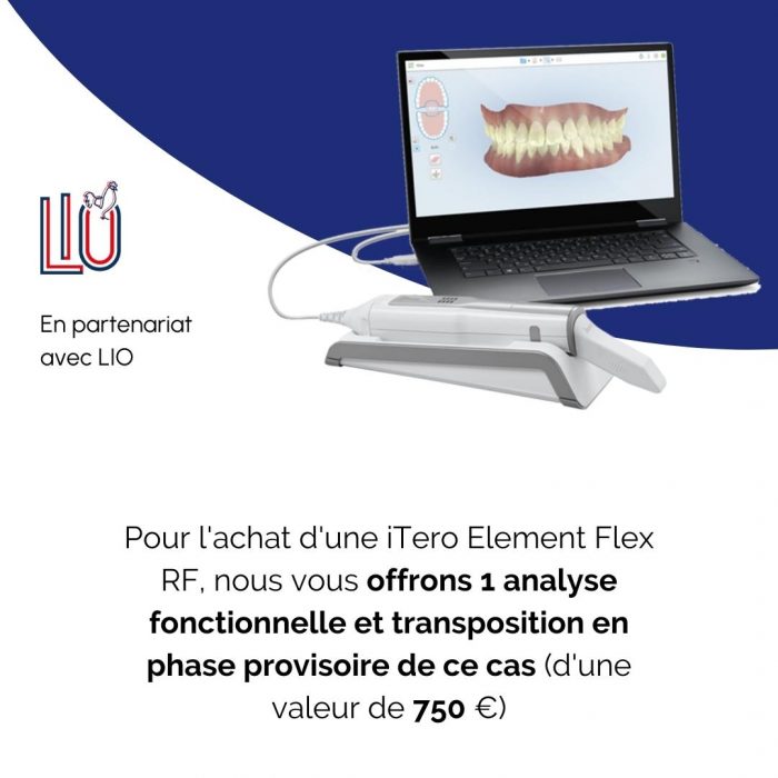 iTero Element Flex - scanner intra-oral